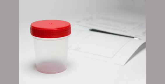 Comprendre mon analyse d’urine (ECBU) | M comme Mutuelle